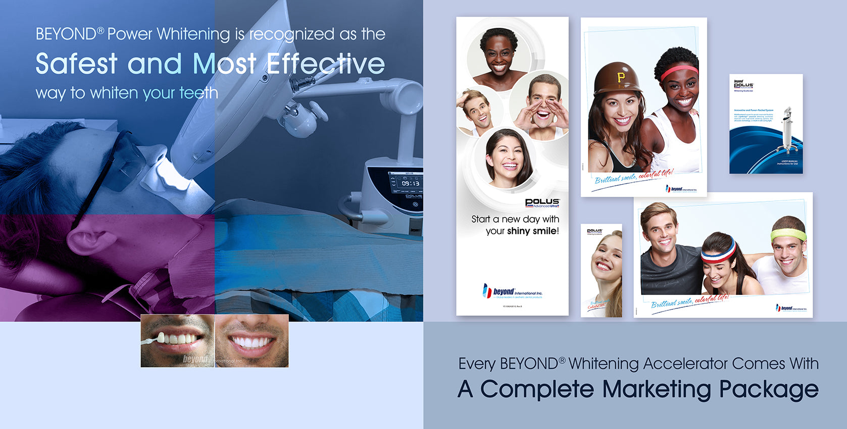 Polus Advanced Ultra Whitening Accelerator – beyonddent