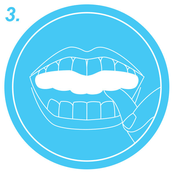 BEYOND CoreWhite Take-Home Whitening Kit (with Universal Tray) – beyonddent